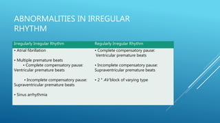 Analyze an Electrocardiogram | PPTX