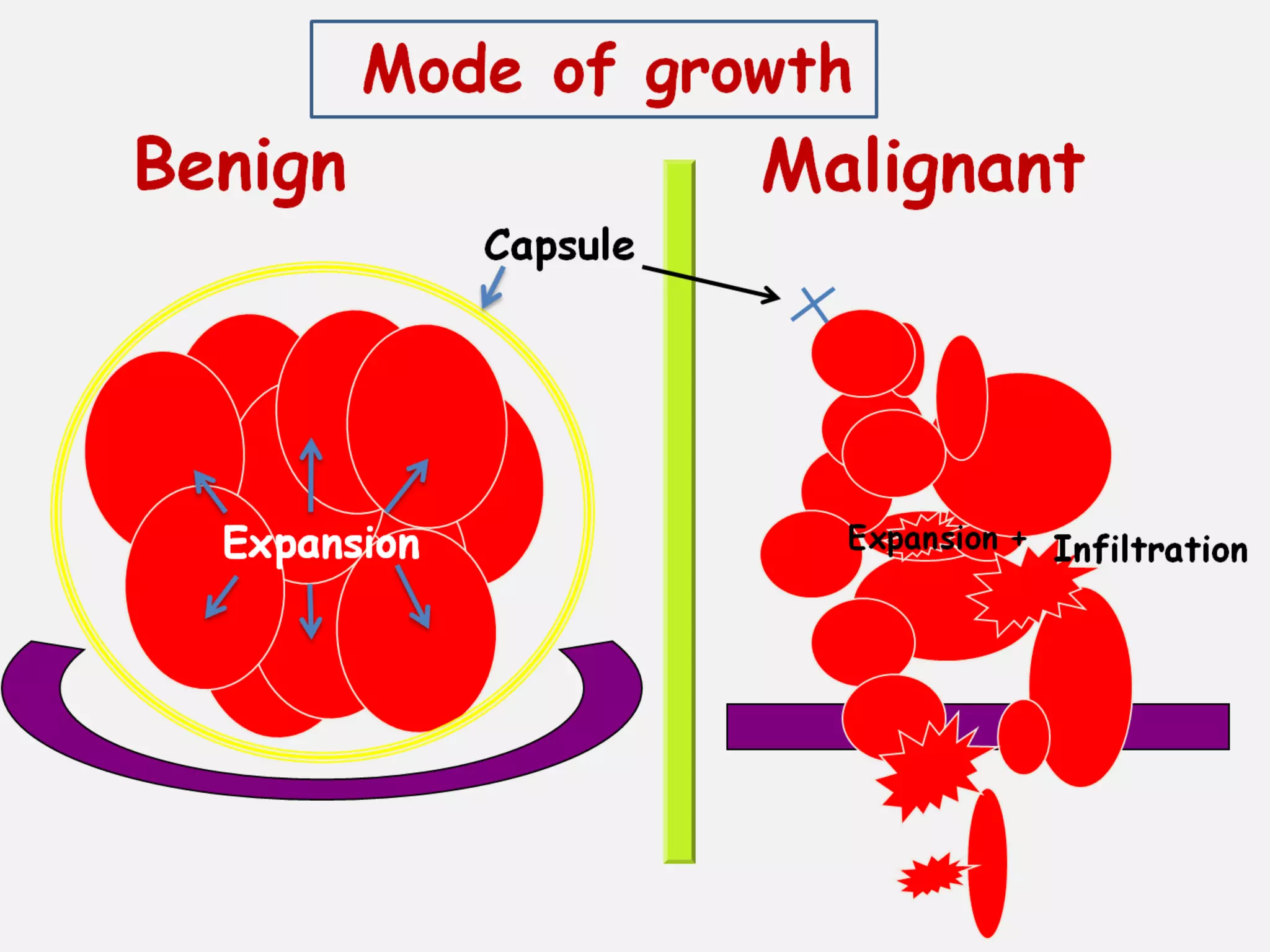 Benign & malignant growth Pathology | PPTX