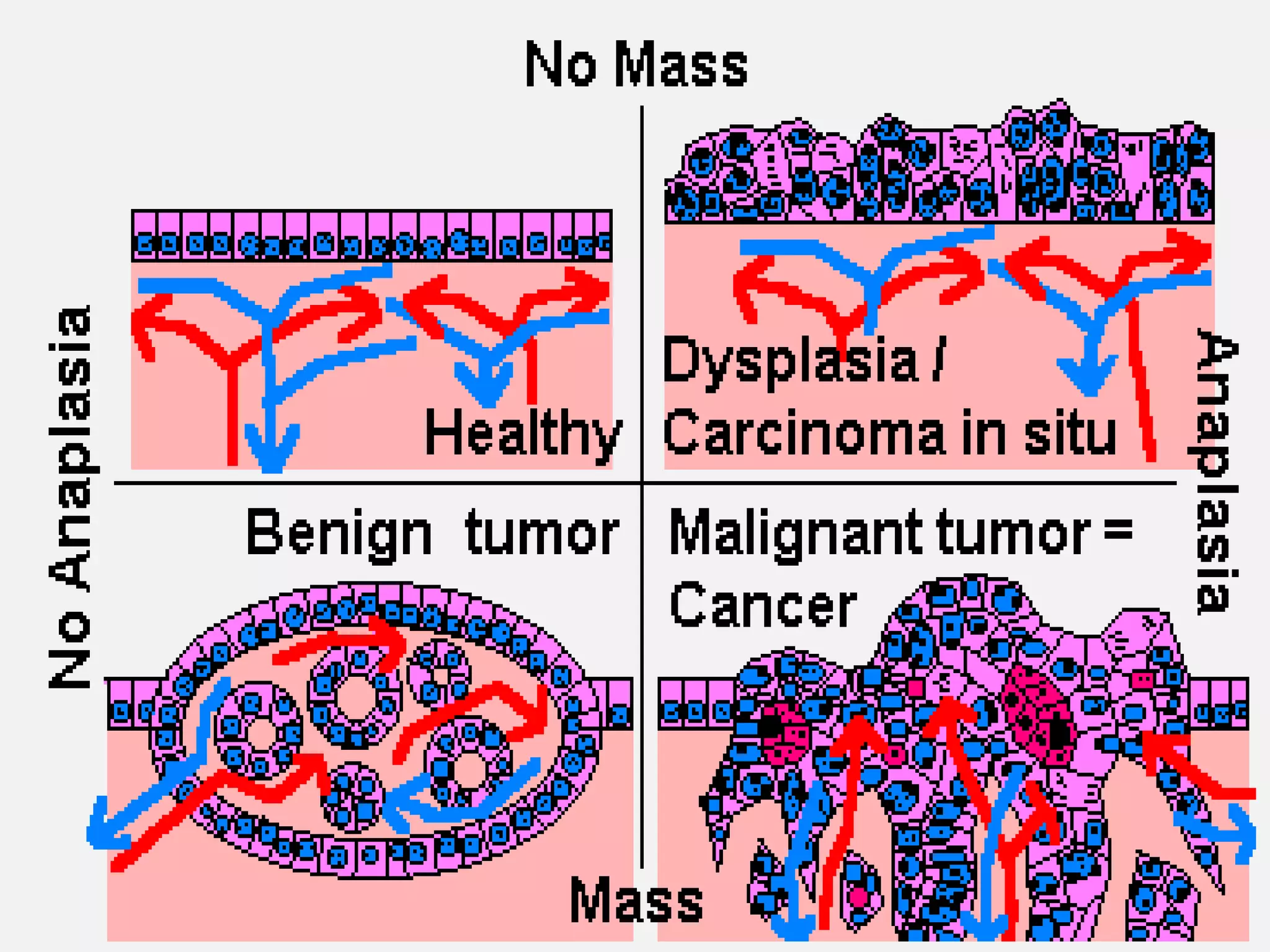 Benign & malignant growth Pathology | PPTX