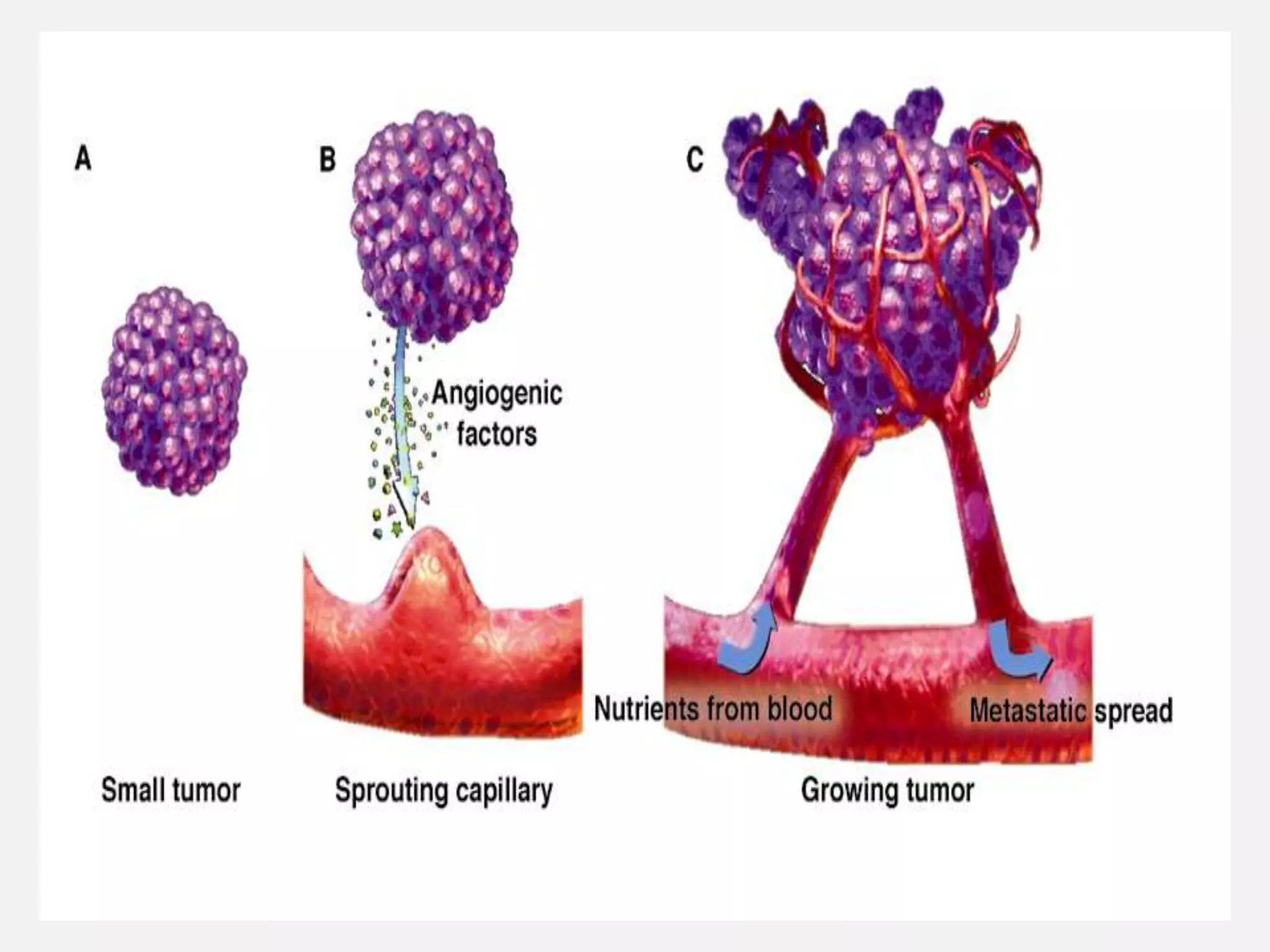 Benign & malignant growth Pathology | PPTX