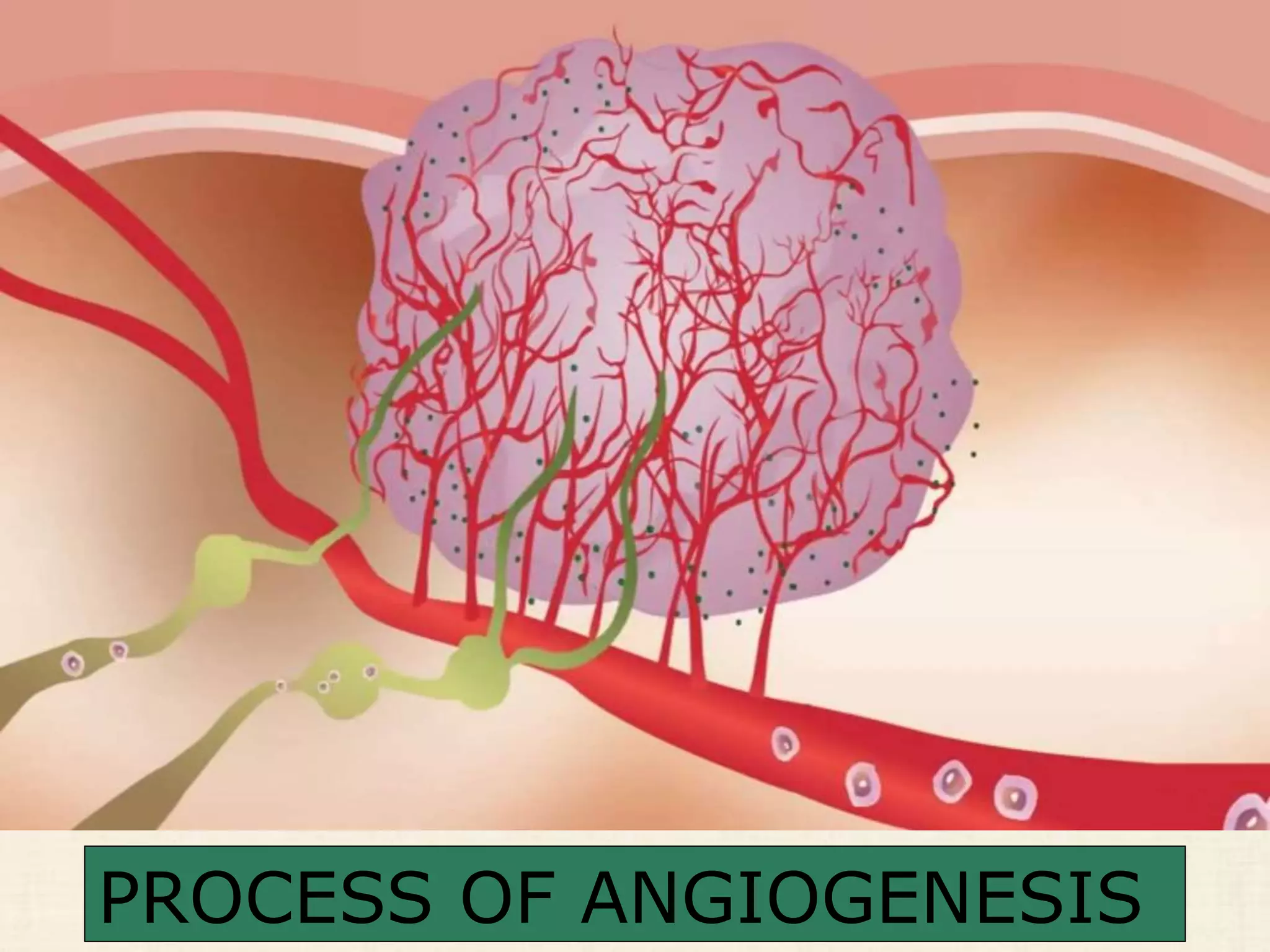Benign & malignant growth Pathology | PPTX