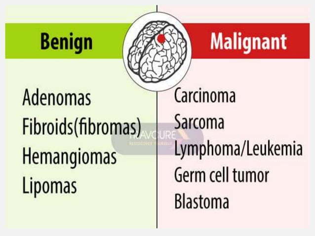 Benign & malignant growth Pathology | PPTX