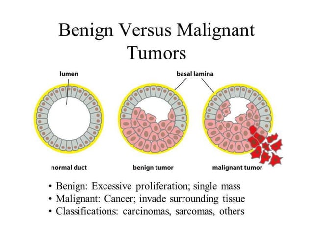 Benign & malignant growth Pathology