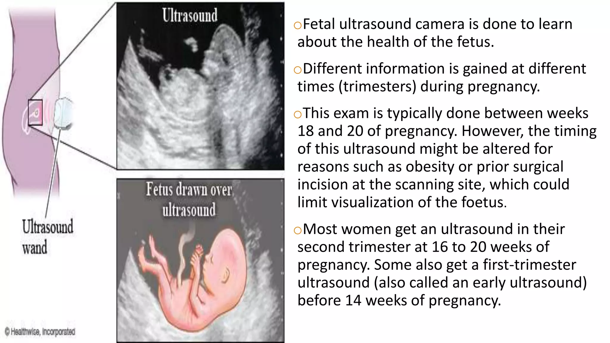 High-risk approach with screening and assessment | PPTX
