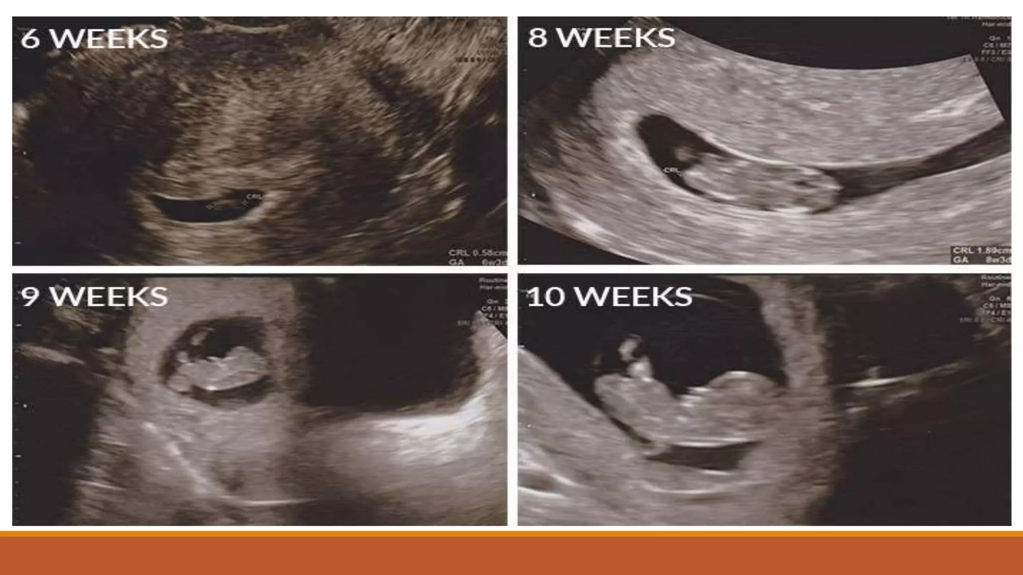High-risk approach with screening and assessment | PPTX