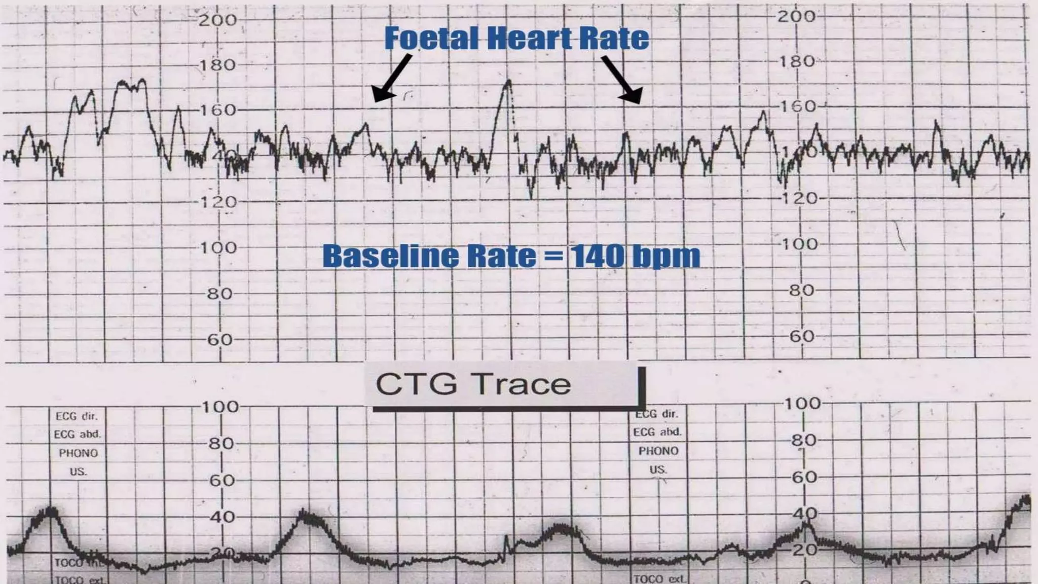 High-risk approach with screening and assessment | PPTX