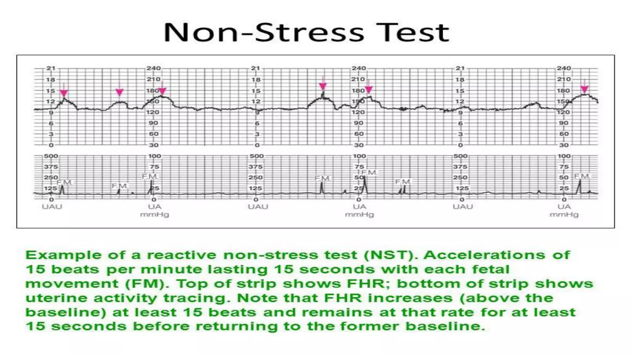 High-risk approach with screening and assessment | PPTX