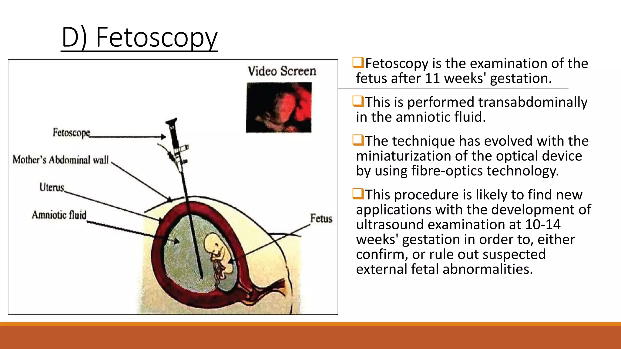 High-risk approach with screening and assessment | PPTX