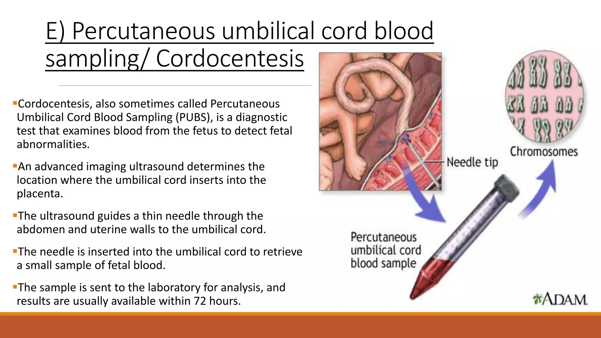 High-risk approach with screening and assessment | PPTX