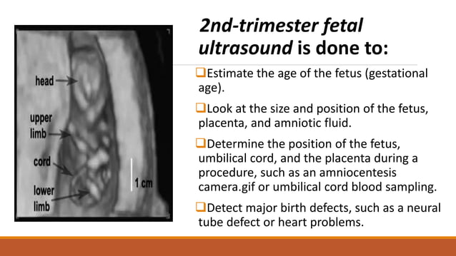 High-risk approach with screening and assessment | PPTX