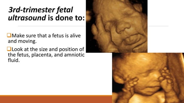 High-risk approach with screening and assessment | PPTX