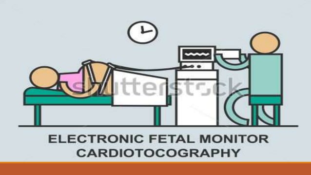 High-risk approach with screening and assessment | PPTX