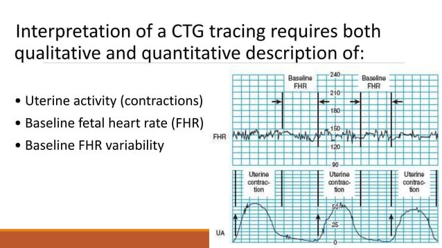 High-risk approach with screening and assessment | PPTX
