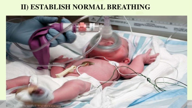 Immediate Nursing care of a newborn