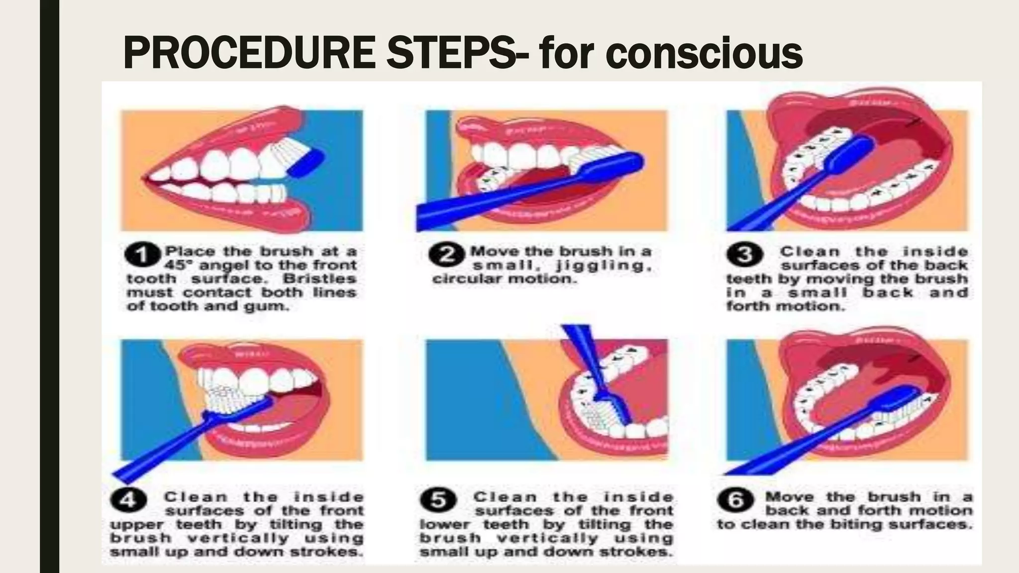 Procedure on oral hygiene | PPTX