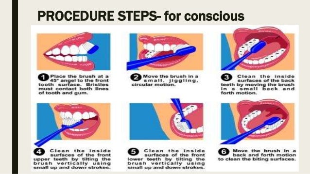 Procedure on oral hygiene