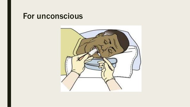 Procedure on oral hygiene