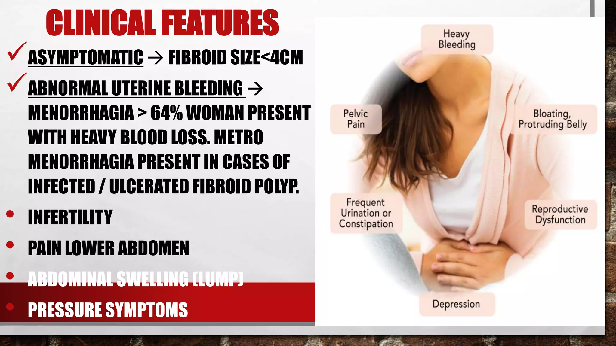 Uterine fibroids introduction and Management | PPTX