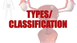 Uterine fibroids introduction and Management | PPTX