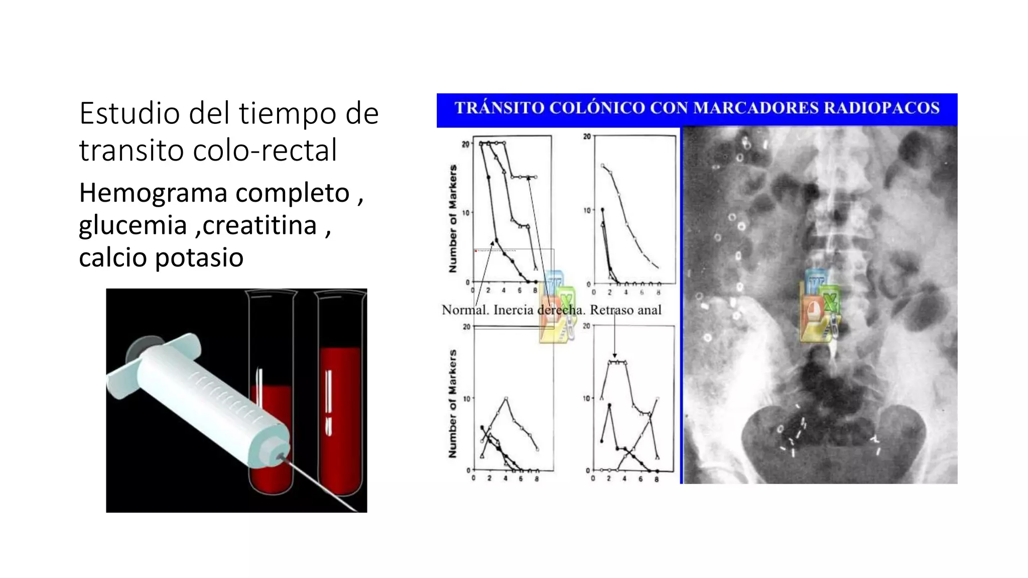 Anamnesis –constipación | PPT
