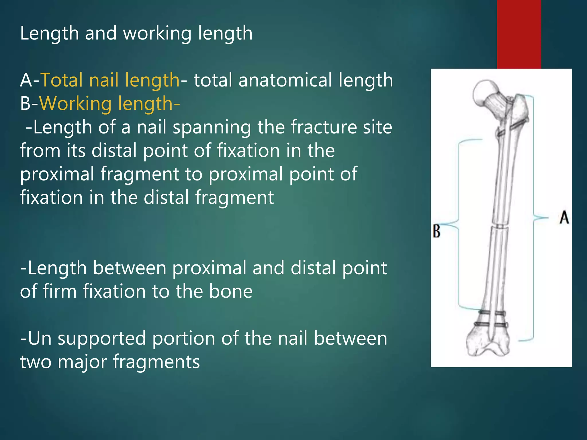 intramedullary nailing | PPTX