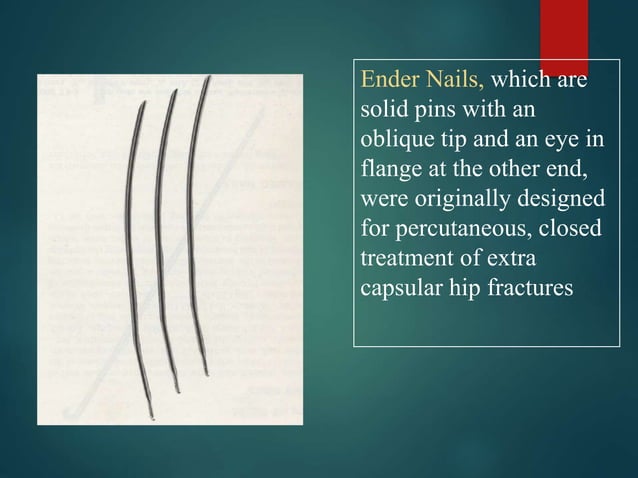 intramedullary nailing | PPTX | First Aid | Injuries