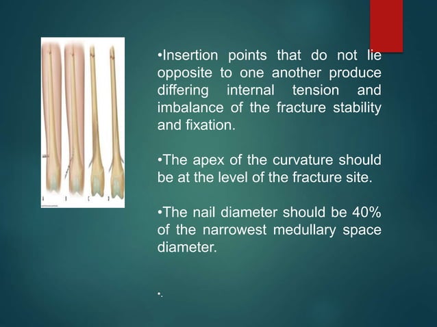 intramedullary nailing | PPTX | First Aid | Injuries
