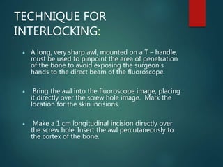 intramedullary nailing | PPTX