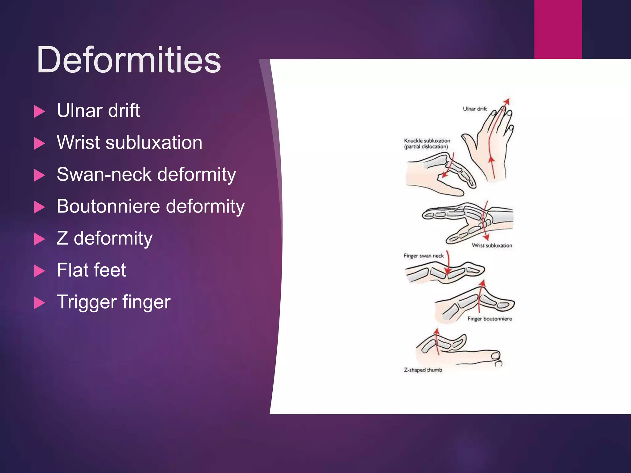 Rheumatoid Arthritis.pptx