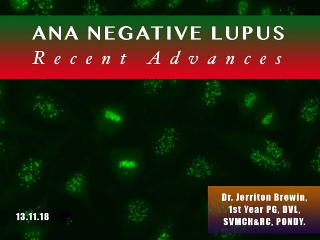 ANA Negative Lupus | PPT