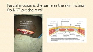A new anterior acetabular approach | PPTX