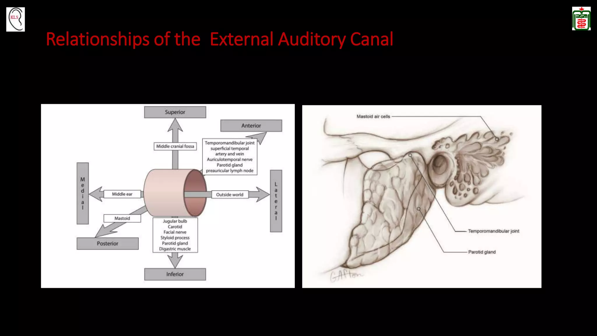 Anatomy Of External Auditory Canal Pptx