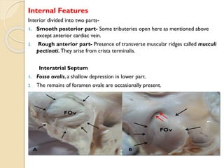 Anatomy Of Heart by Dr Rahul Sharma | PDF | Heart and Cardiovascular ...