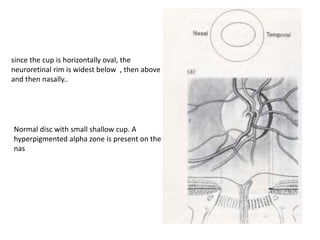 Anatomy of optic nerve | PPTX