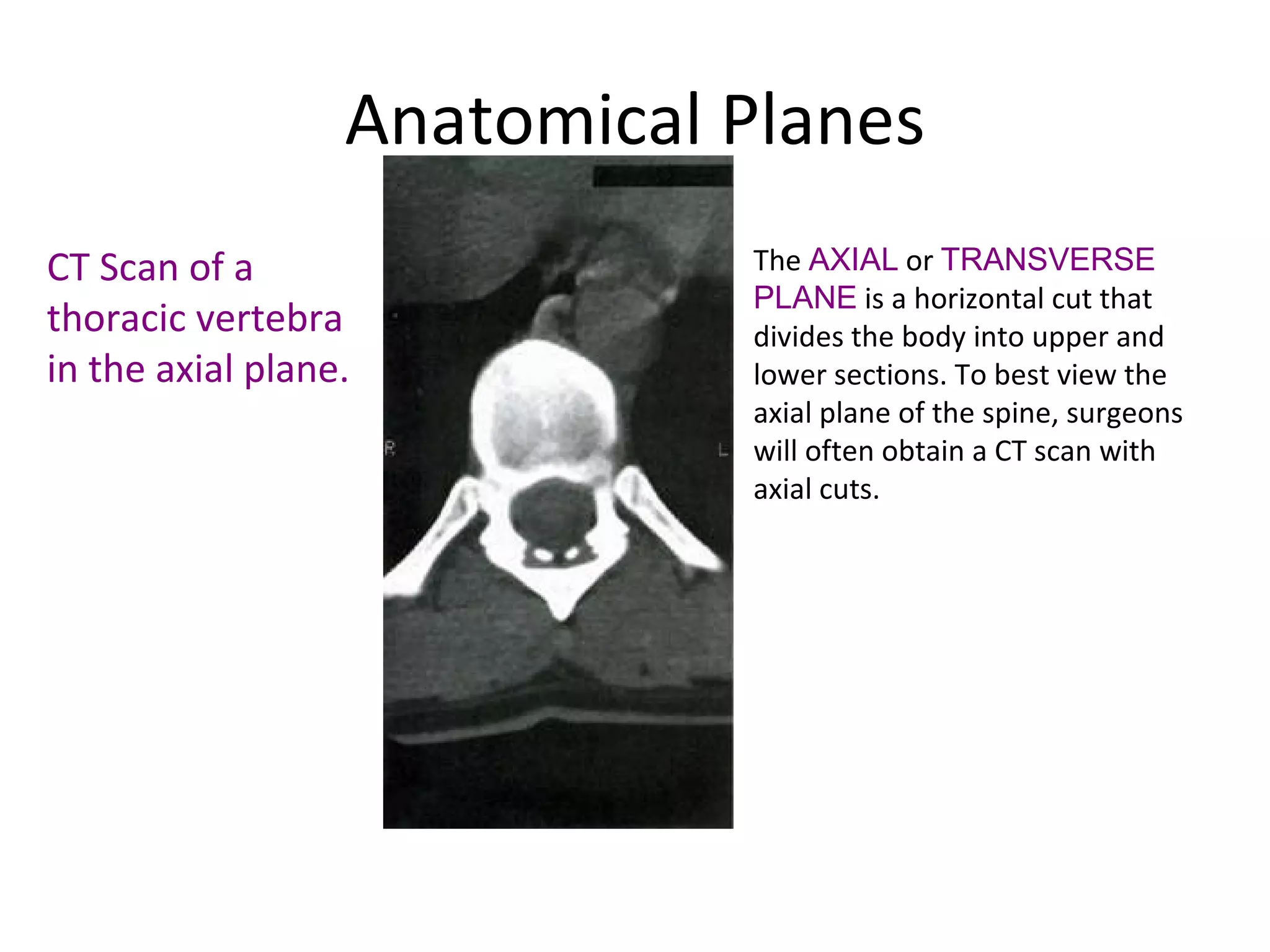 Anatomy of spine | PPT