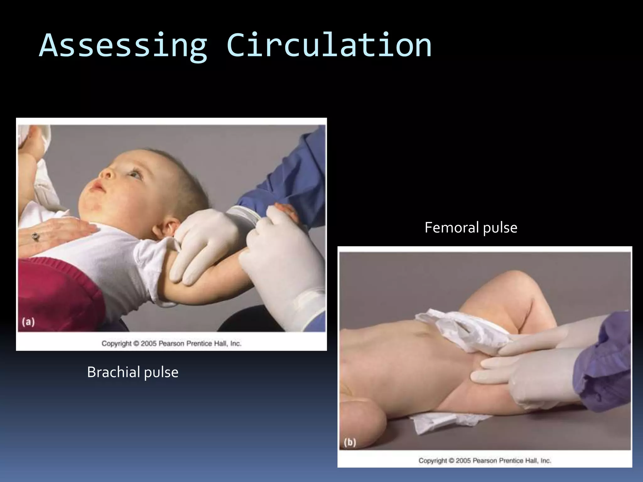 PEDIATRIC ANAPHYLAXIS | PPTX