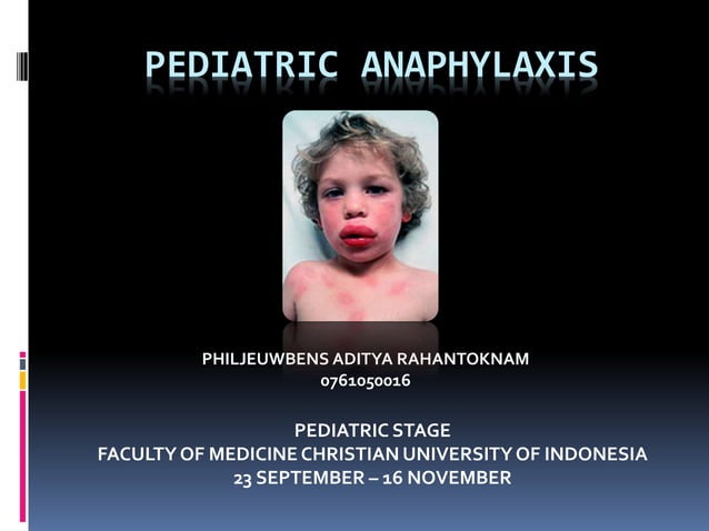 PEDIATRIC ANAPHYLAXIS | PPTX | Lung and Respiratory Health | Diseases ...