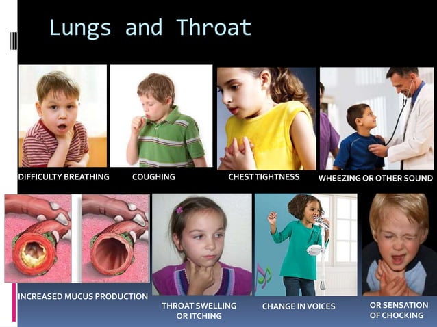 PEDIATRIC ANAPHYLAXIS | PPTX | Lung and Respiratory Health | Diseases ...
