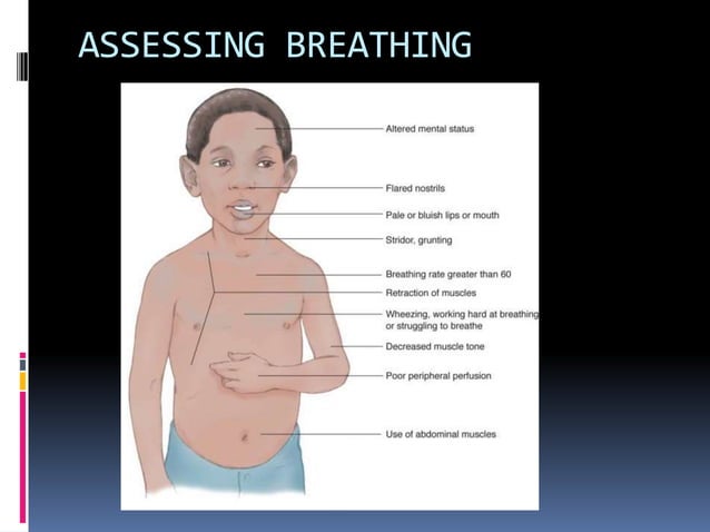 PEDIATRIC ANAPHYLAXIS | PPTX | Lung and Respiratory Health | Diseases ...