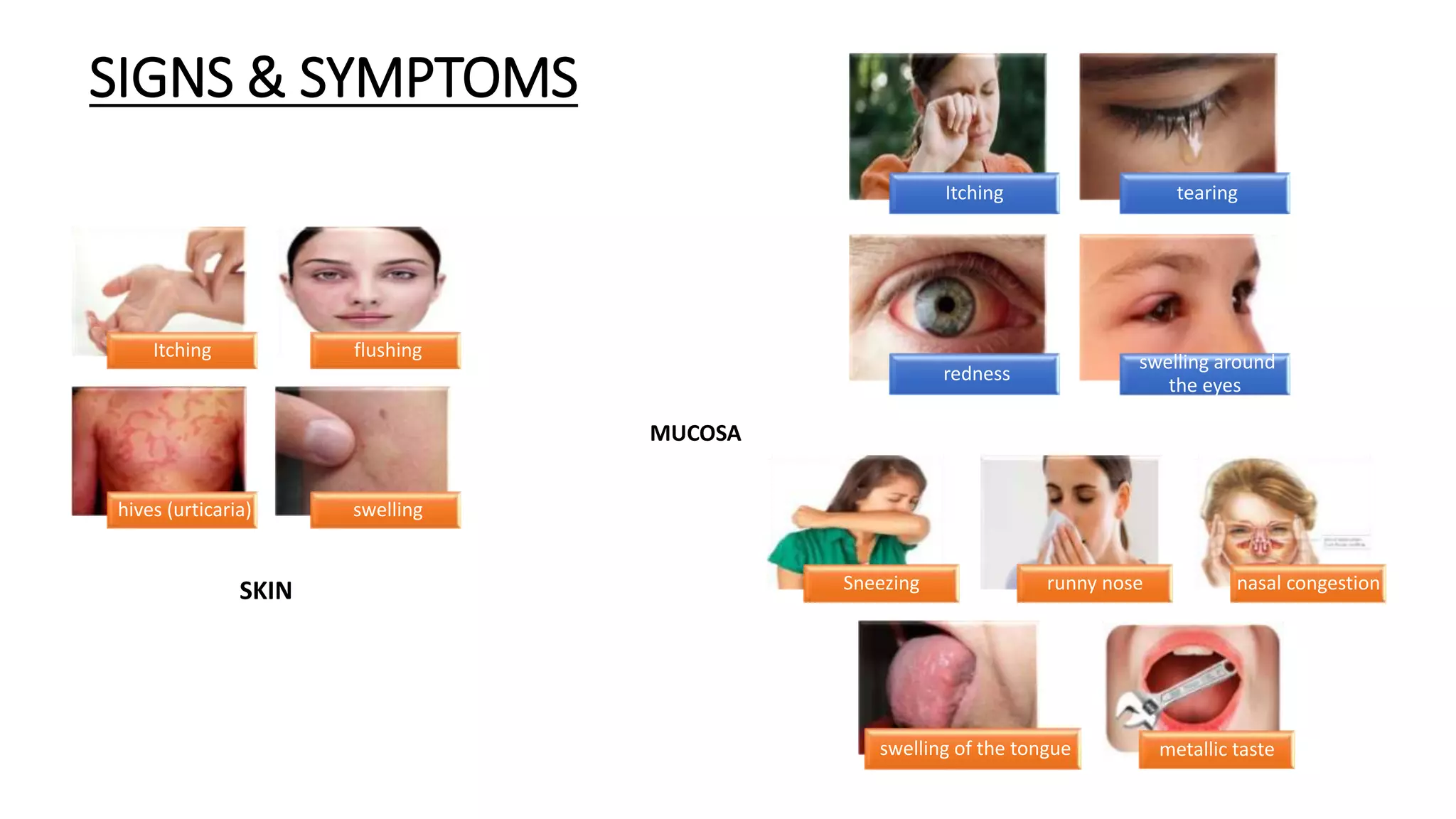 Anaphylactic shock | PPTX