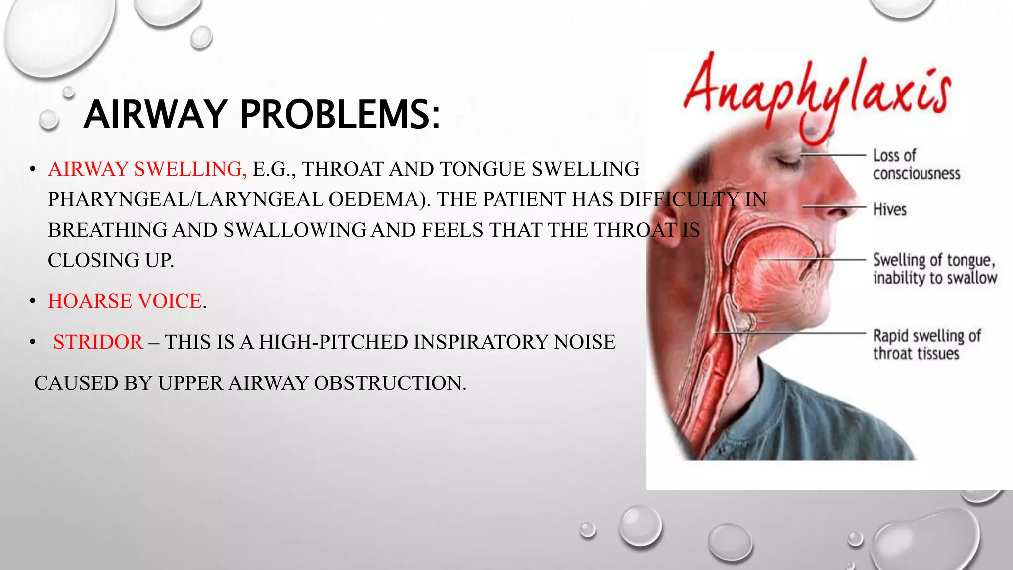 Anaphylactic shock | PPTX