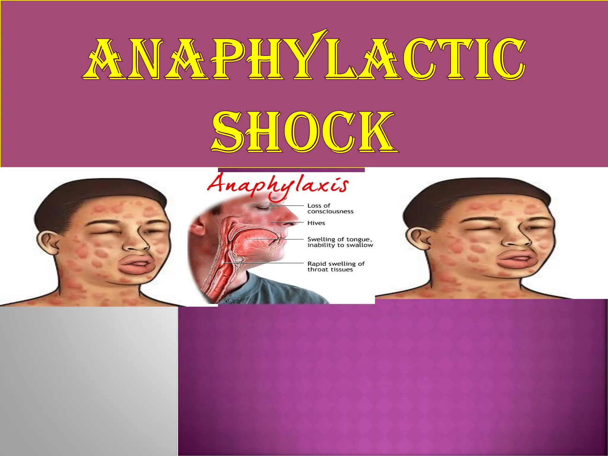 anaphylactic shock and its various types pdf | PDF | First Aid | Injuries