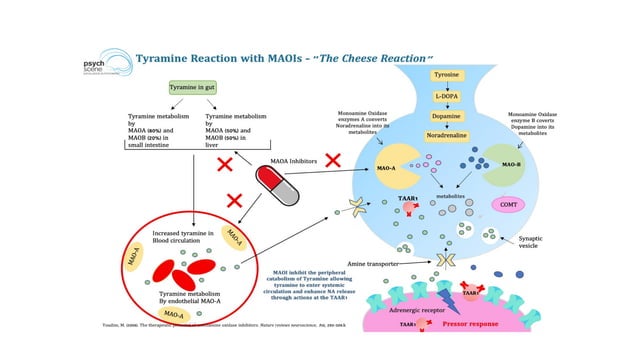 Anaphylactic Shock, Cheese Reaction, Digoxin+Quinidine.pptx