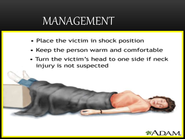 Anaphylatic shock (1) | PPTX