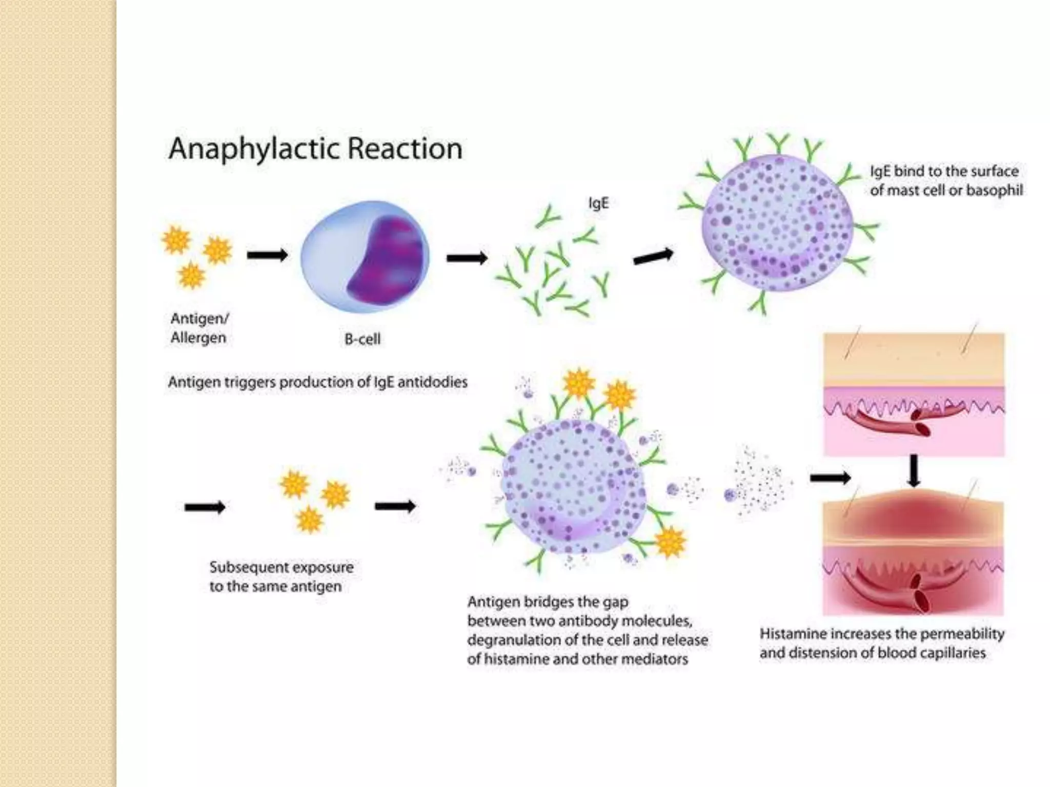 Anaphylaxis | PPTX