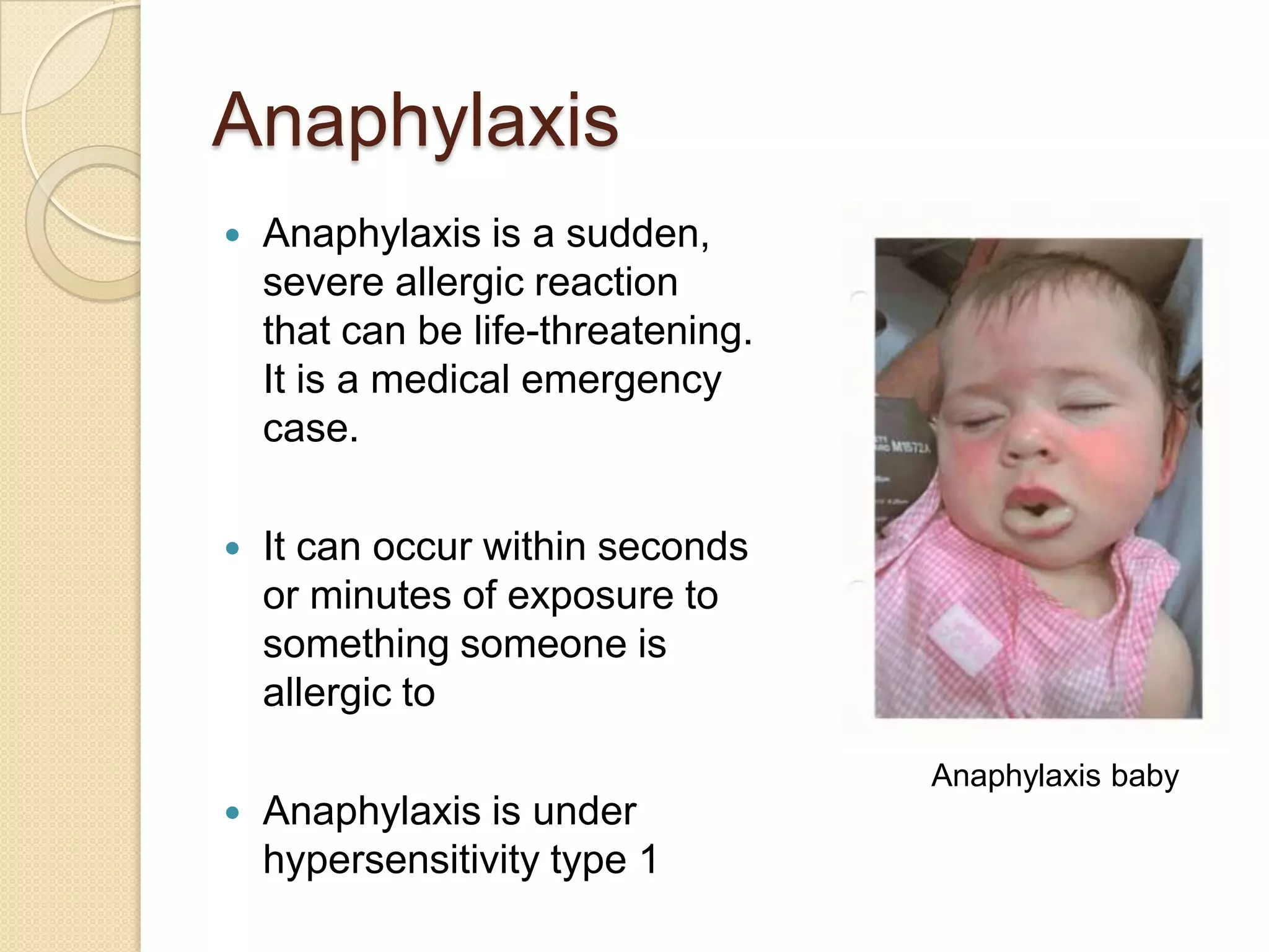 Anaphylaxis | PPTX