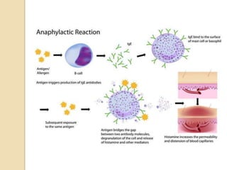 Anaphylaxis | PPTX