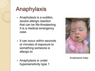 Anaphylaxis | PPTX