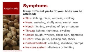 Anaphylaxis | PPT