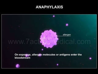 Anaphylaxis | PPTX